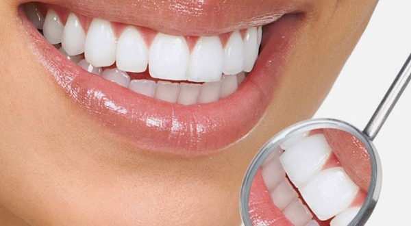 Los 4 Mejores Blanqueadores Dentales 【Funcionan】 ️